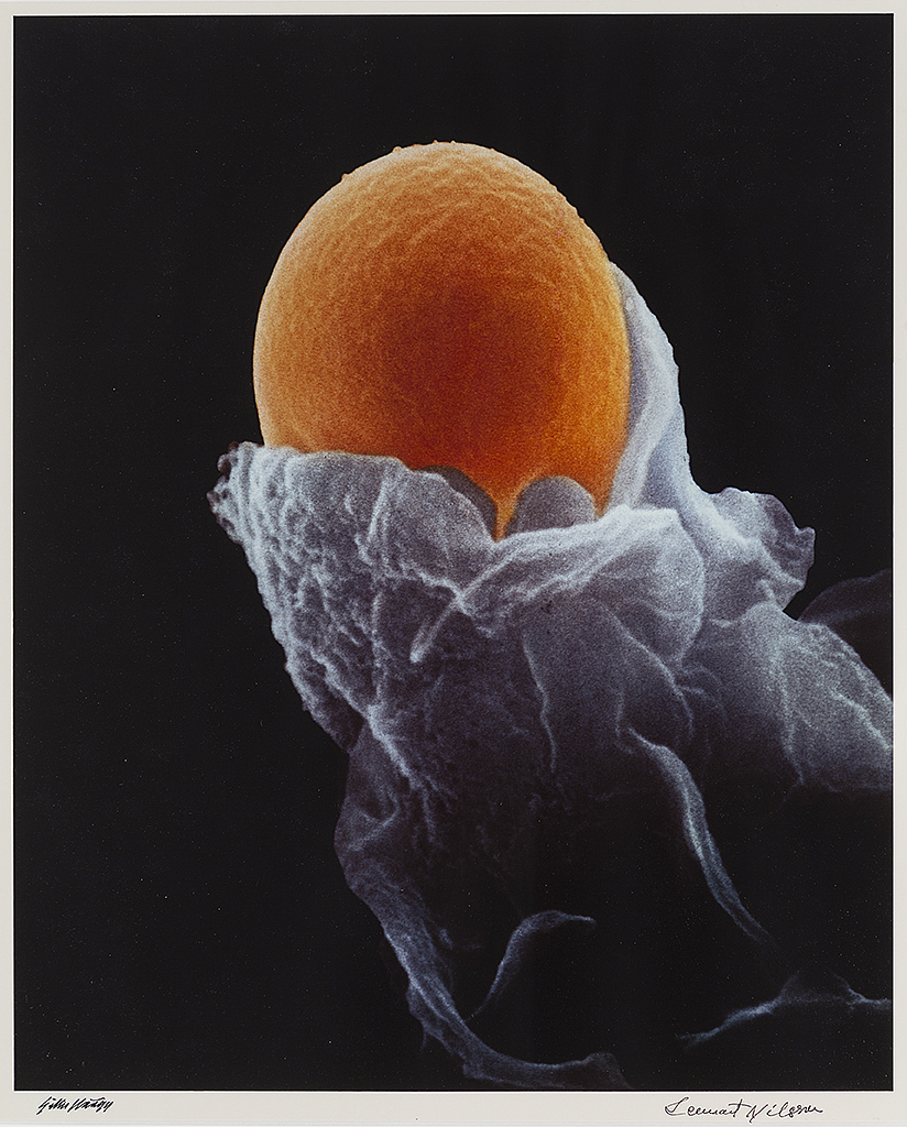LENNART NILSSON, a cibachrome, signed. - Bukowskis