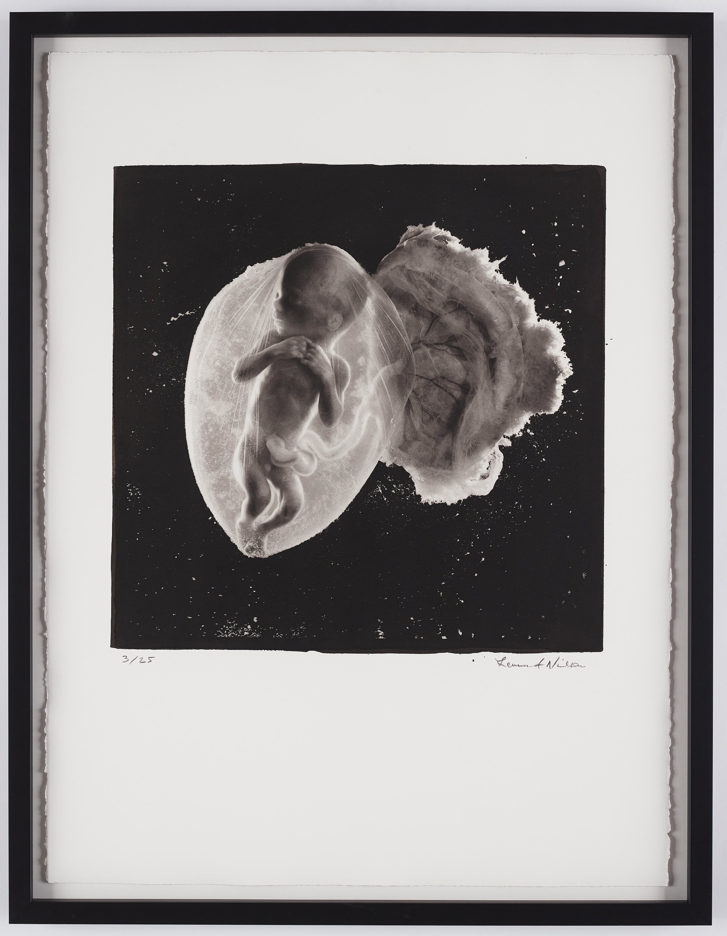 Lennart Nilsson, "Foster, 18 veckor", 1965. - Bukowskis