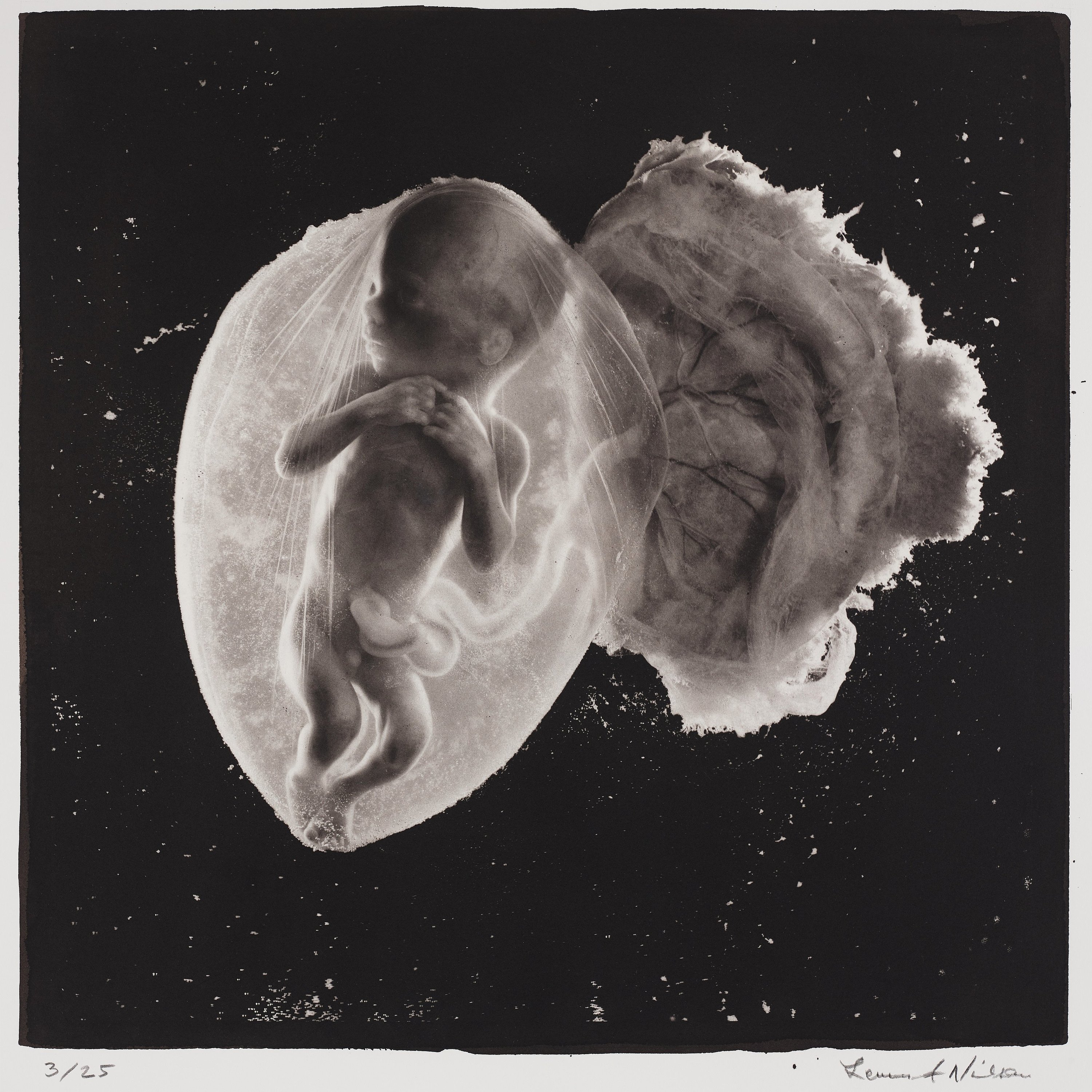 Lennart Nilsson, "Foster, 18 veckor", 1965. - Bukowskis